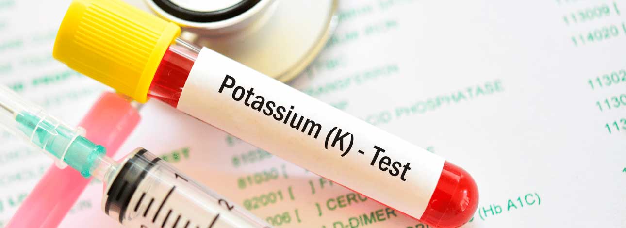 Você Sabe O Que é o Exame de Potássio? Veja Sua Importância!
