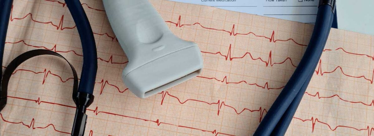 Ecocardiograma: O Que Você Precisa Saber Sobre esse Exame?