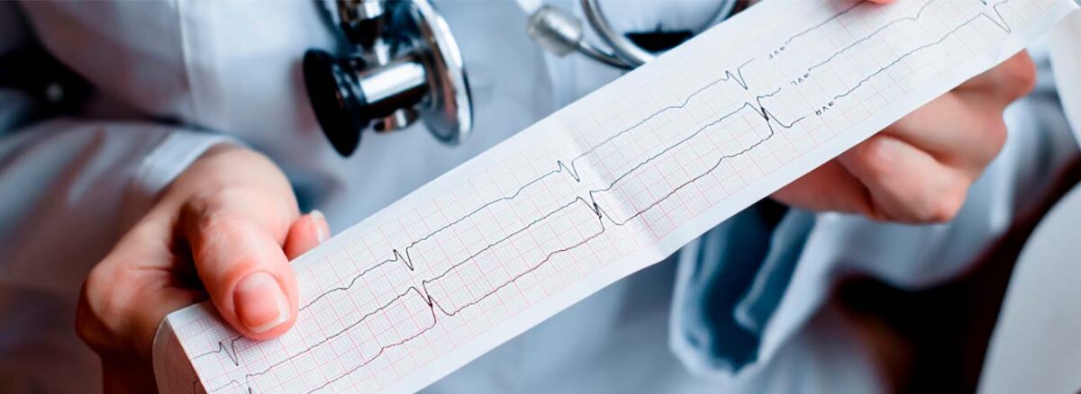 Check-Up Cardiológico na SPX Clínica