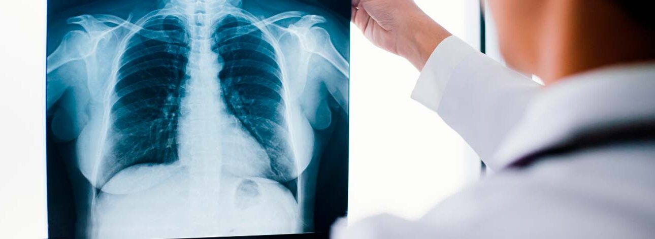 Conheça os Exames de Check-up da SPX Clínica Joinville