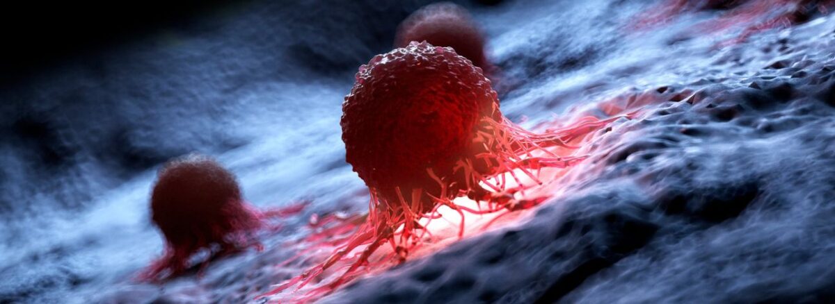 Guia aponta grupos para Triagem de Tumor Colorretal