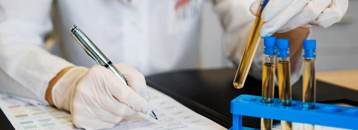 Por que Fazer o Exame de Creatinina e Ureia? Entenda!