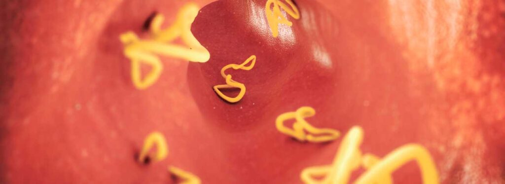 Sinais de Verme no Corpo: Saiba Quais São e Como Prevenir